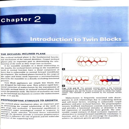 Twin Block appliance in orthodontics .pptx