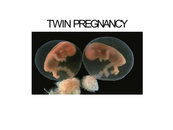 Multiple Pregnacy- Diagnosis and Investigations.pptx