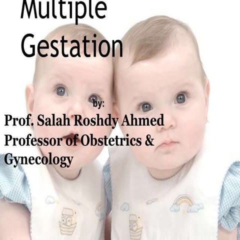 Multifetal pregnancy (Twins Pregnancy) | PPTX