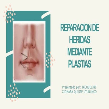 Plastias en z, retraccion de cicatrices. principios de las cirugía ...
