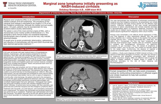 Primary Follicular Lymphoma of the spleen: A Case report and literature ...