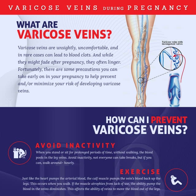 Varicose Veins During Pregnancy | PDF