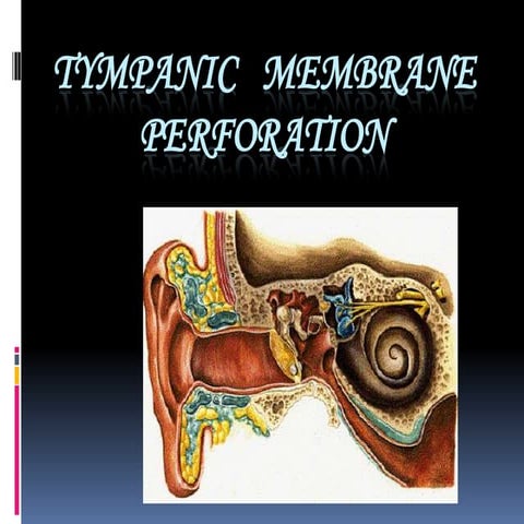 Tympanic membrane | PPT