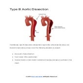 Type B Aortic Dissection