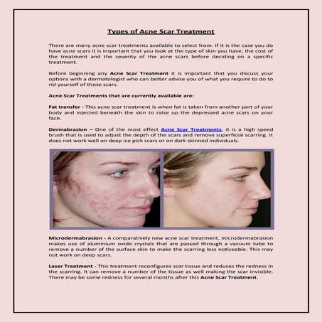 Acne Scar Treatment: Which Works? | Dr. Monisha Kapoor | PPTX