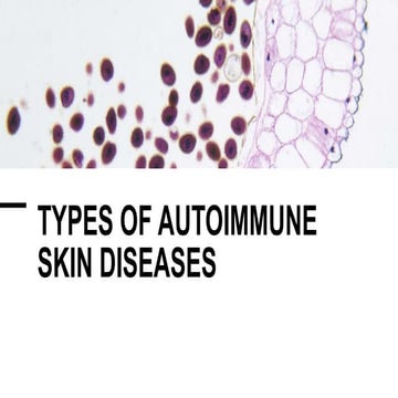 TYPES OF AUTOIMMUNE SKIN DISEASES_.pptx | Skin and Dermatology ...