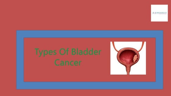 Shoulder Pain Causes | PPTX