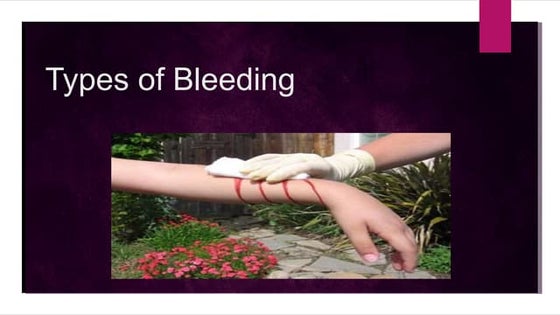 Controlling External Bleeding | PPTX | First Aid | Injuries