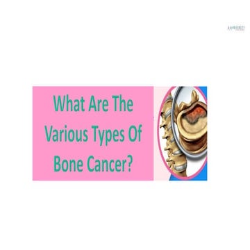 Types of Bone Cancer | PPTX