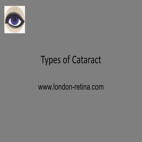 Types of cataract | PPTX | Eye and Vision Conditions | Diseases and ...