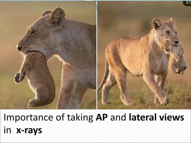 Anterior cerebral circulation | PPTX