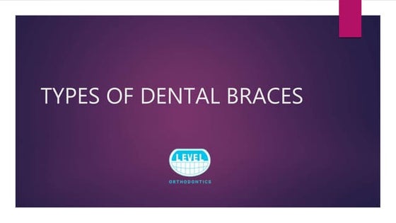 Types of braces | PDF