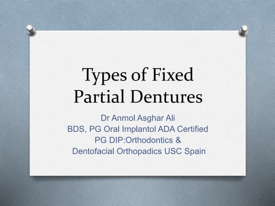 clasps in removable orthodontic appliance | PPT