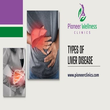 Liver disorder- | PPTX
