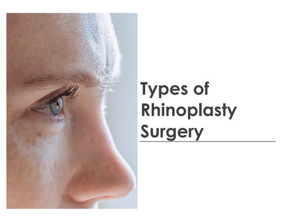 What Is Nasal Turbinate Reduction? | PDF