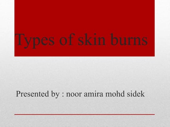 The burns | PPTX
