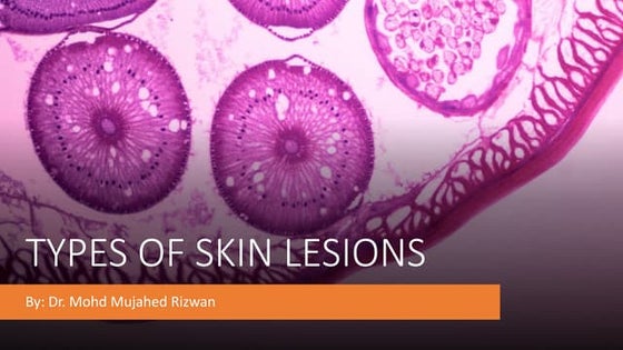Common terms in skin diseases in human.pptx