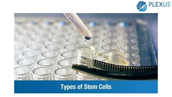 The Importance of Stem Cells | Plexus | PPTX
