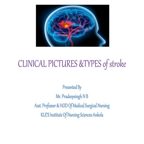 Stroke | PPTX