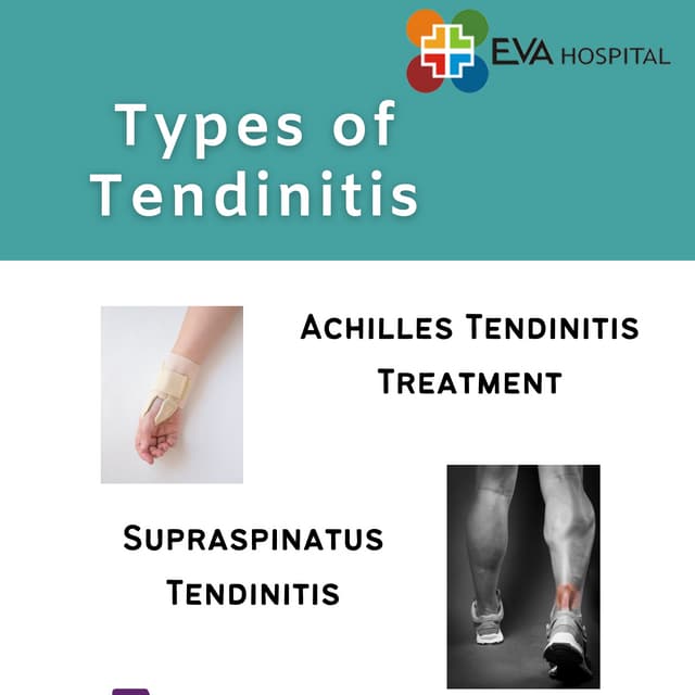 Types of Tendinitis | PDF