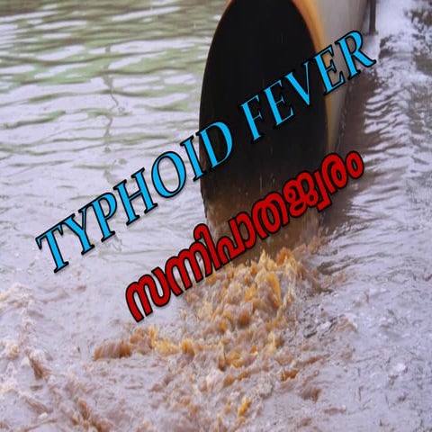 Typhoid | PPT