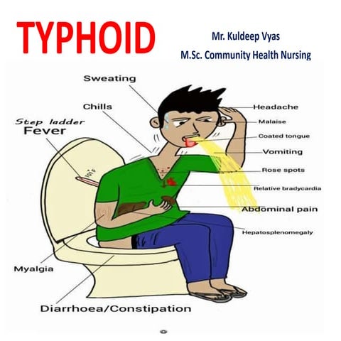 Typhoid | PPTX