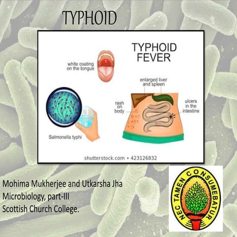 Typhoid fever 1 | PPTX | Infectious Diseases | Diseases and Conditions