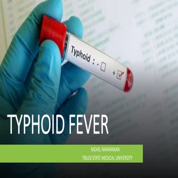Typhoid fever overview | PPTX