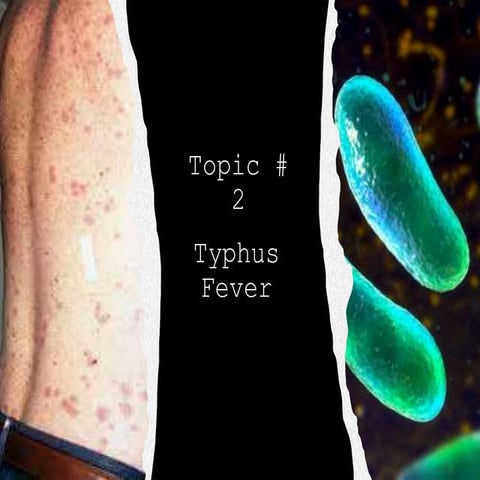 Typhus Fever and its epidemiology worldwide.pptx