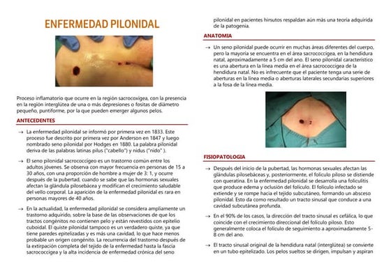 Enfermedad pilonidal e hidradenitis | PDF | Ear, Nose and Throat ...