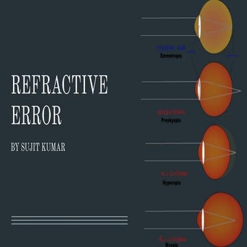 Refractive error | PDF