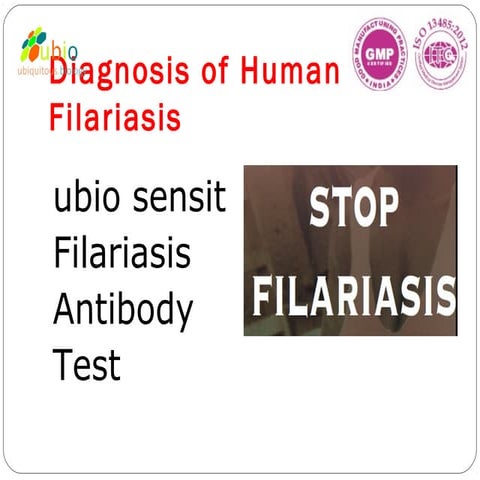 ubio sensit Filariasis Antibody rapid test | PPT