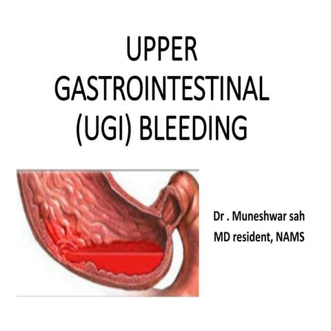Ugi bleeding muneshwar | PPTX