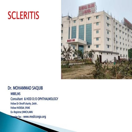 SCLERITIS | PPT