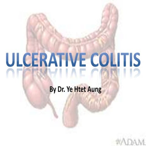 Ulcerative colitis | PPTX