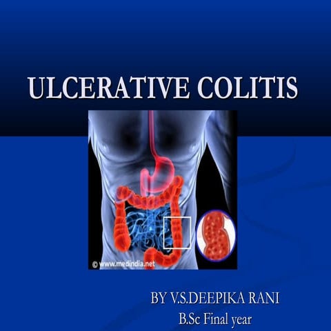 Ulcerative colitis | PPT