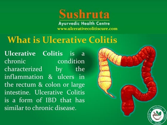 Running head ULCERATIVE COLITIS CONCEPT MAP 1 .docx | Digestive ...