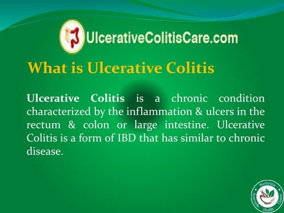 Ulcerative Colitis.pptx
