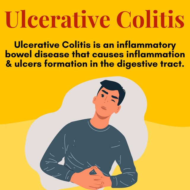 Ulcerative Colitis Signs and Symptoms.pdf | Digestive Disorders ...
