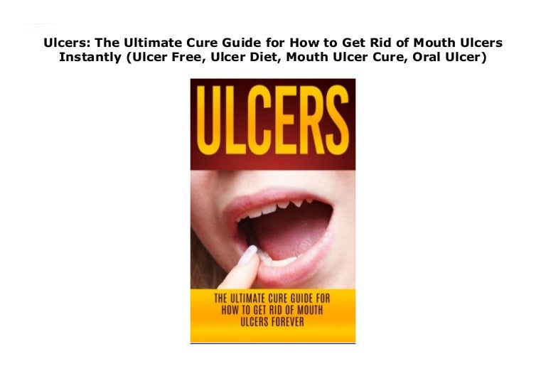 Ulcers: The Ultimate Cure Guide for How to Get Rid of Mouth Ulcers In… Ulcers: The Ultimate Cure Guide for How to Get Rid of Mouth Ulcers In…