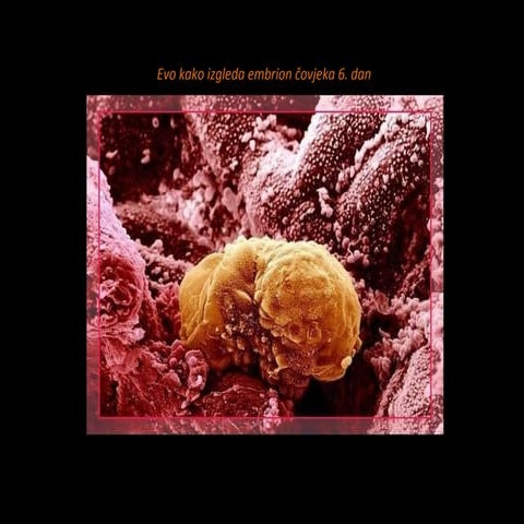 U ljudskom tijelu | PPS