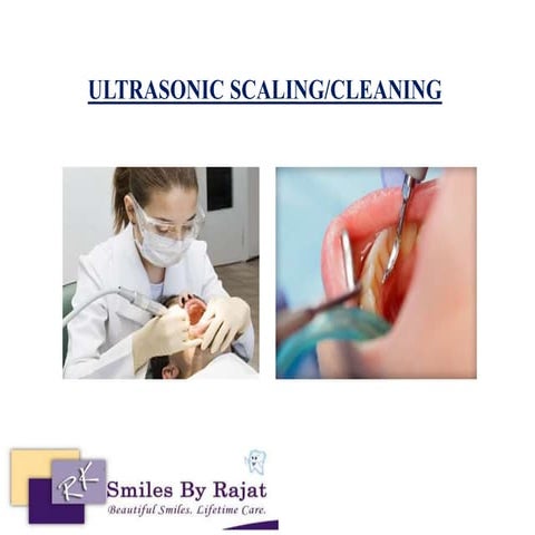 Ultrasonic scaling . | PPTX