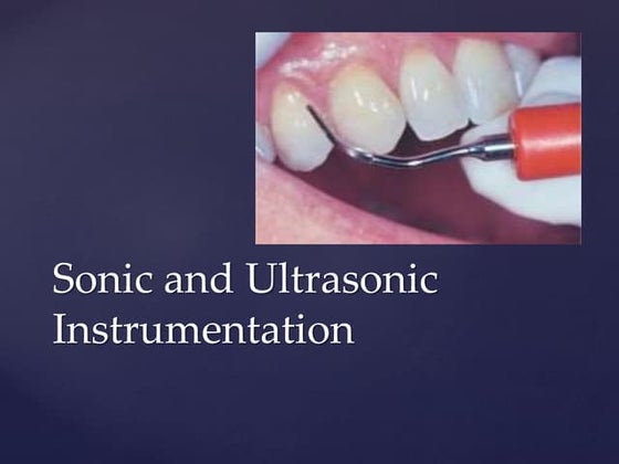 Sonics and ultrasonics in endodontics | PPT | Oral care | Personal Care