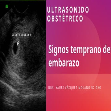 Ultrasonido obstétrico signos temprano del embarazo | PPTX