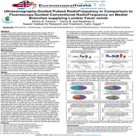 Ultrasonography guided pulsed radio frequency in comparison to fluoroscopy-guided conventional ...