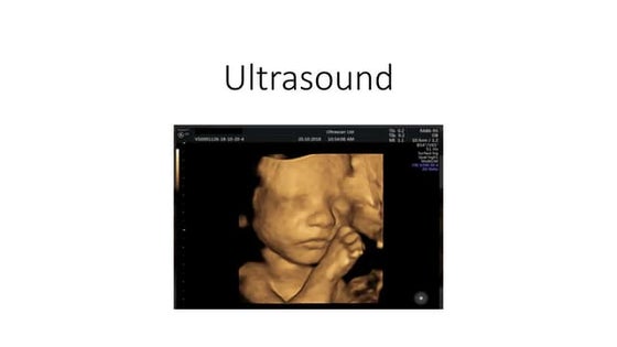 Therapeutic Ultrasound treatment of Physiotherapy | PPT