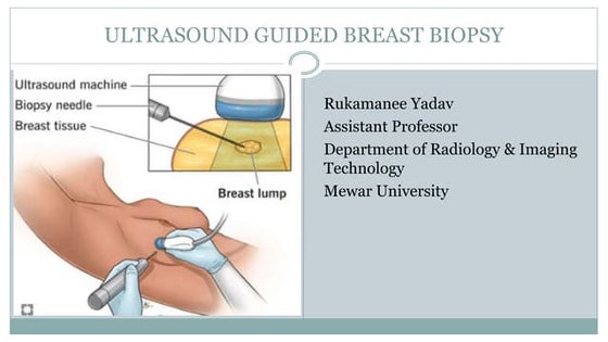 all about Ultrasound guided biopsy by radiology decode | PPT