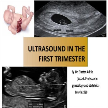 ultrasound in 1st TM.pdf