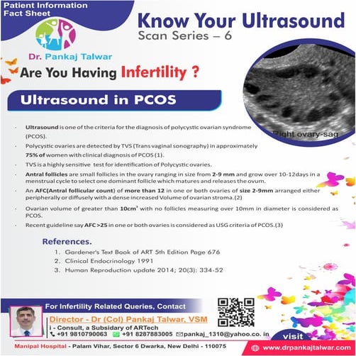 #Ultrasound in #Pcos | PDF