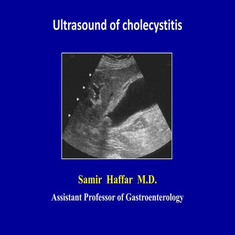 Ultrasound of acute & chronic cholecystitis | PPTX